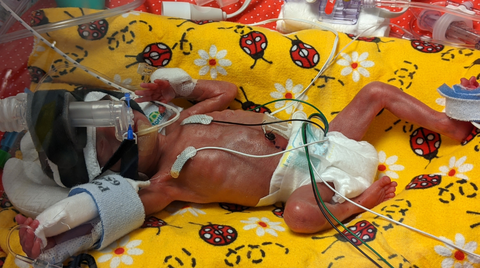 Crisis and Compassion: A Family’s Journey Through the Elliot NICU ...